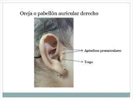 Apéndice Preauricular, ¿Problema Grave o Estético? | Preauricular A...