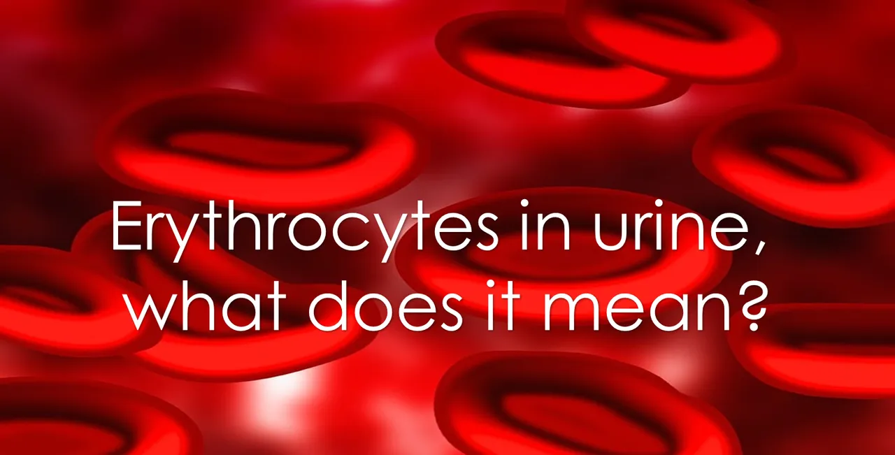 Erythrocytes in urine, what does it mean?
