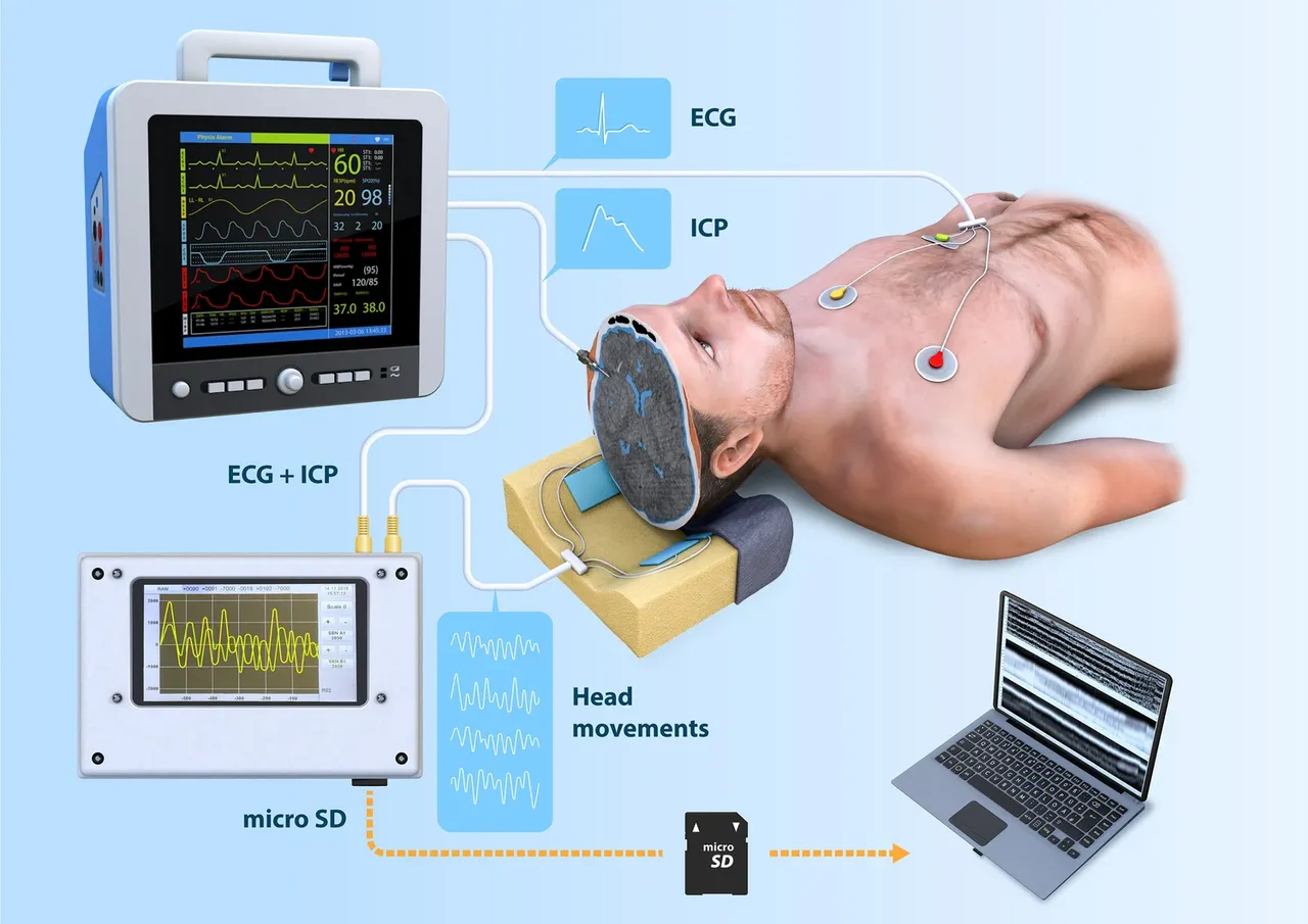 Intracranial Pressure (ICP) Monitoring