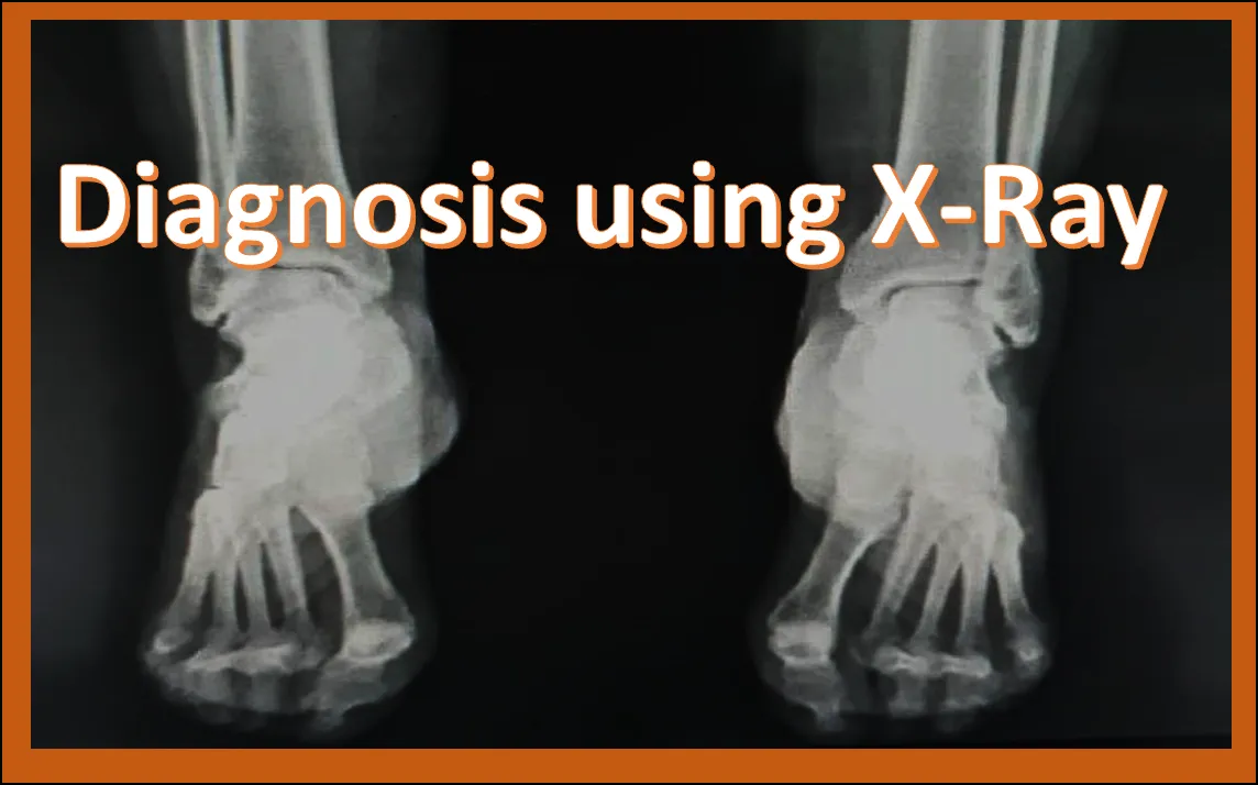 Diagnosis using X-Ray - Real case
