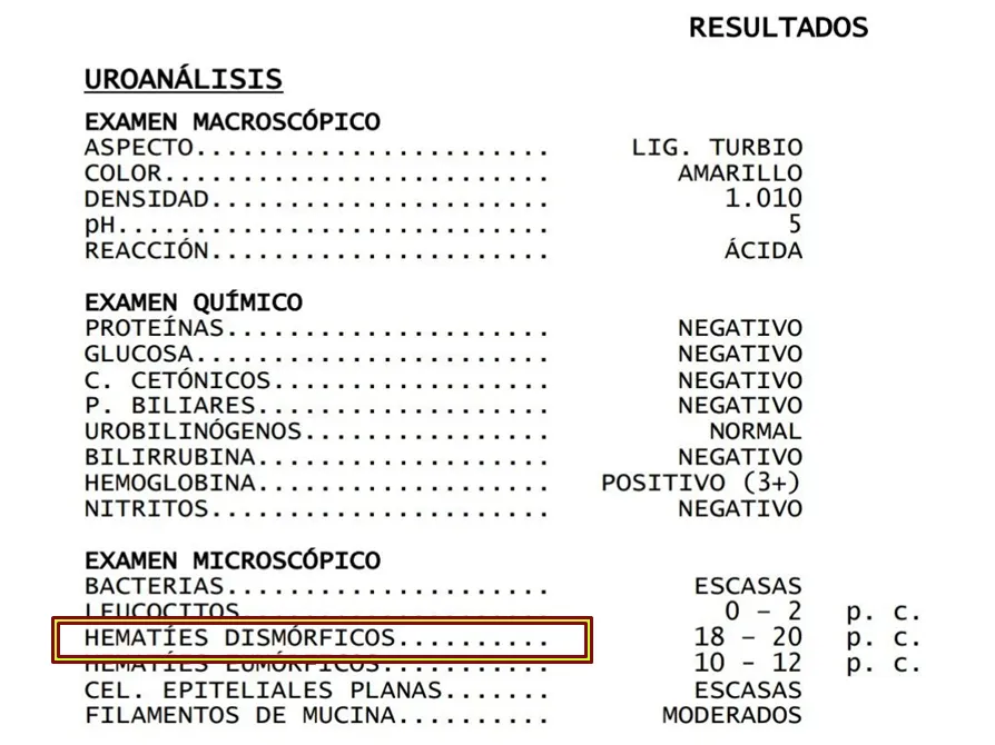 Erythrocytes in urine, what does it mean?