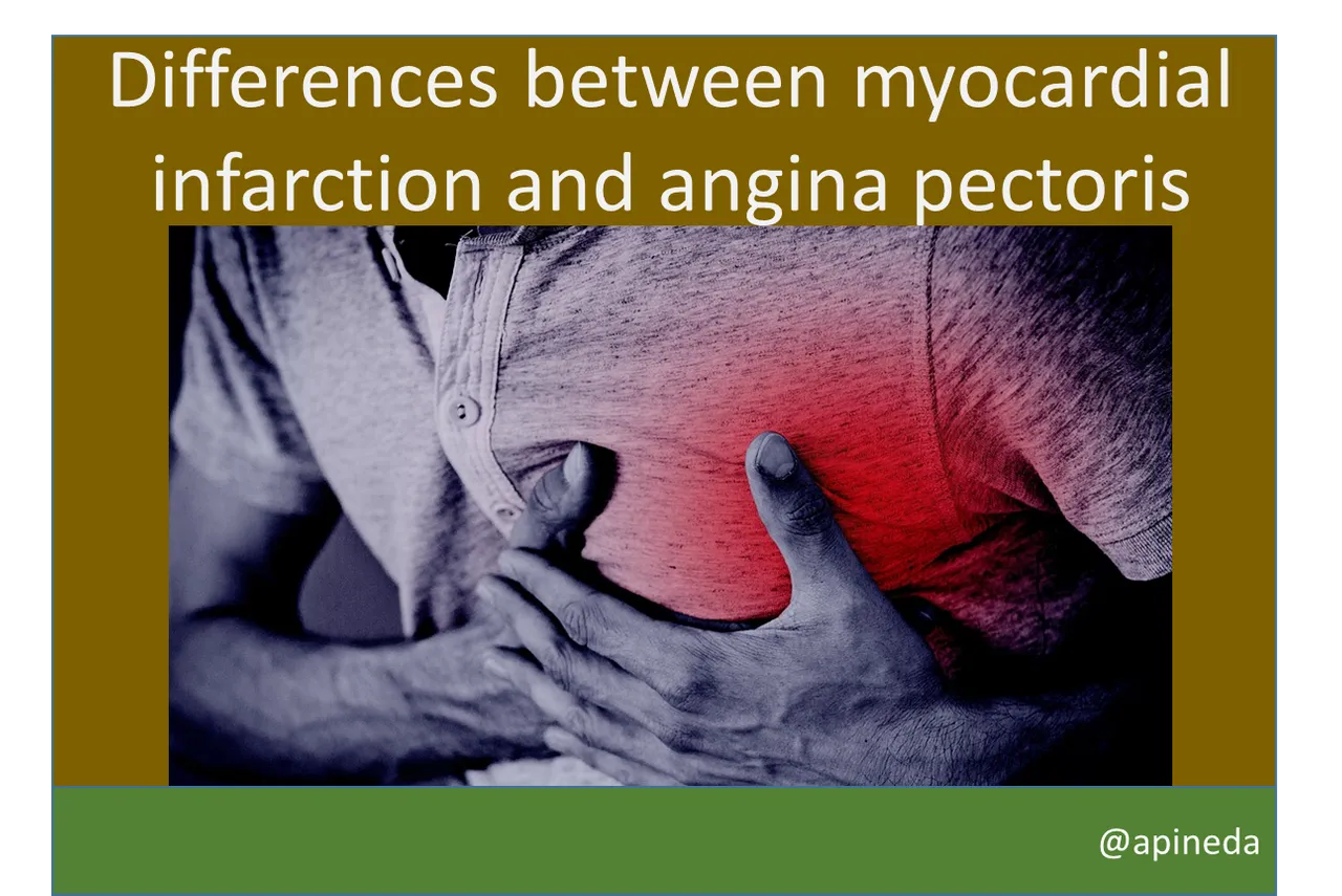 Differences between myocardial infarction and angina pectoris