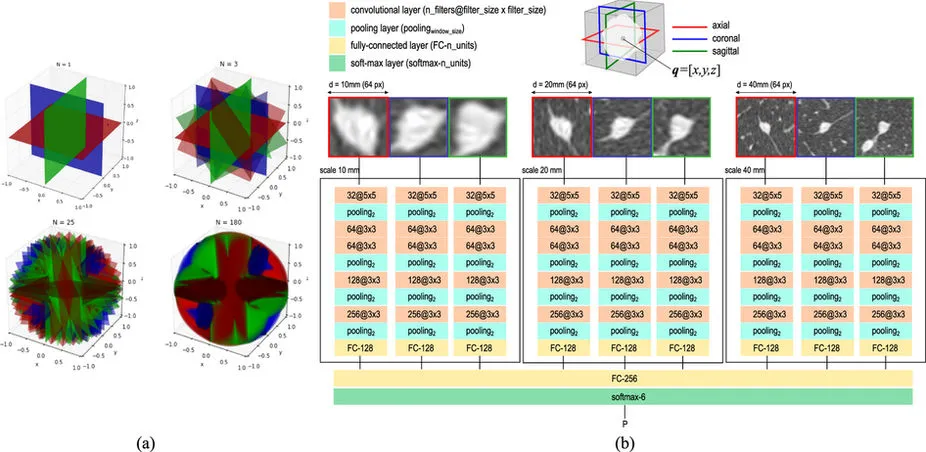 [BME, CS, radiology] 폐결절(pulmonary nodule)을 분류(classification)하기 위한...