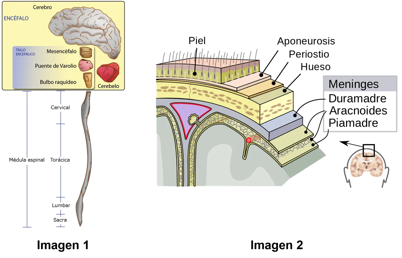 Estudio comparativo entre una hemiplejía por lesión medular y una h...