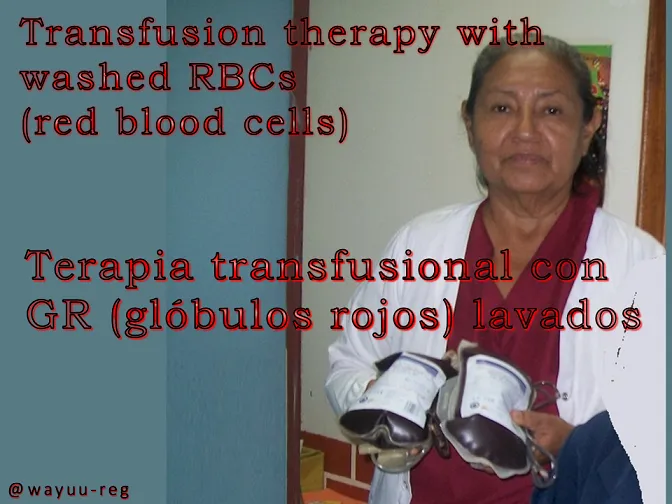 [EN//ES] Transfusion therapy with washed RBCs (red blood cells)