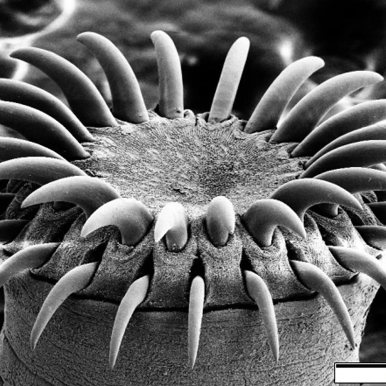 Explaining the Tapeworm Species and Tapeworm Infection