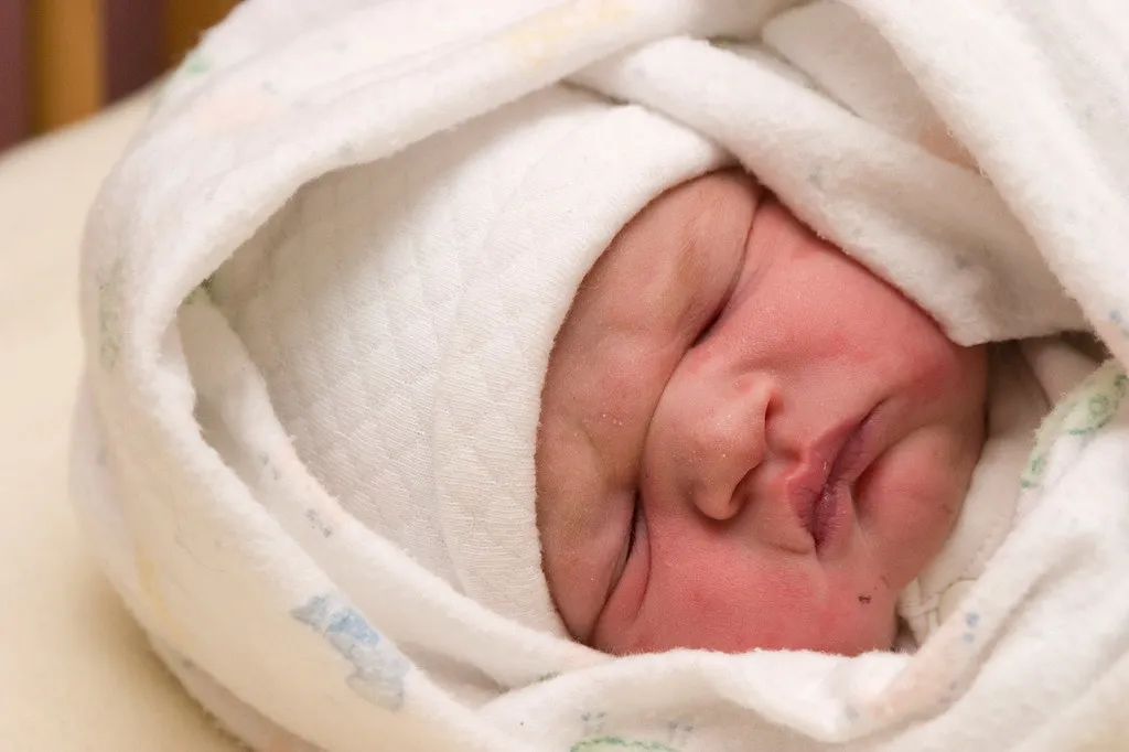 The Reason behind Sunken Fontanel in Infants.