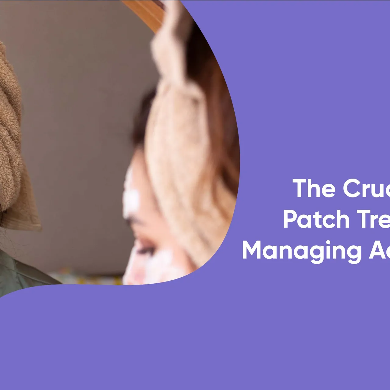 The Crucial Role of Patch Treatments in Managing Acne-Prone Skin