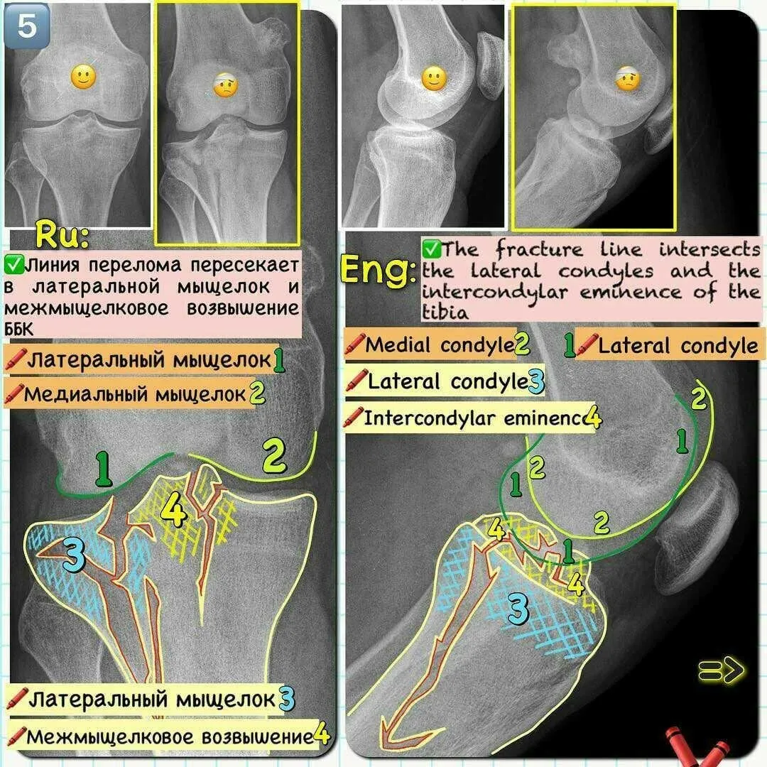 Radiology And Anatomy Of The Knee Joint (Patella).