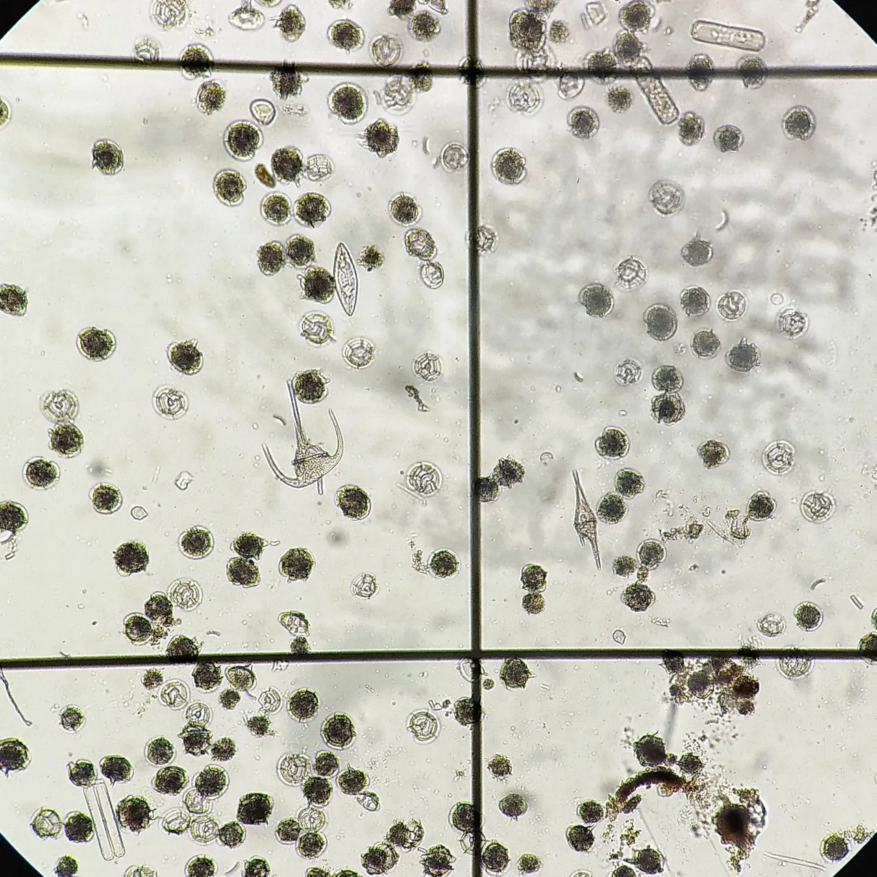 Red Tide under the Microscope